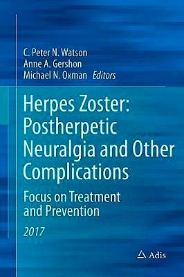 Herpes Zoster. Postherpetic Neuralgia and Other Complications. Focus on ...